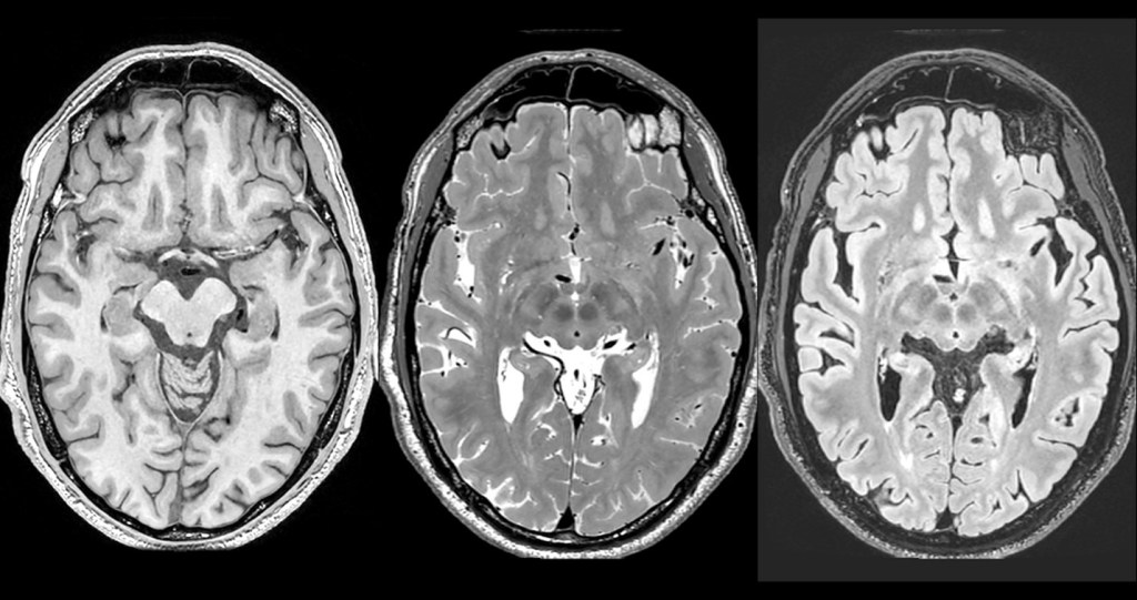 Researchers hope to unlock brain’s mysteries with new MAGNUS MRI ...