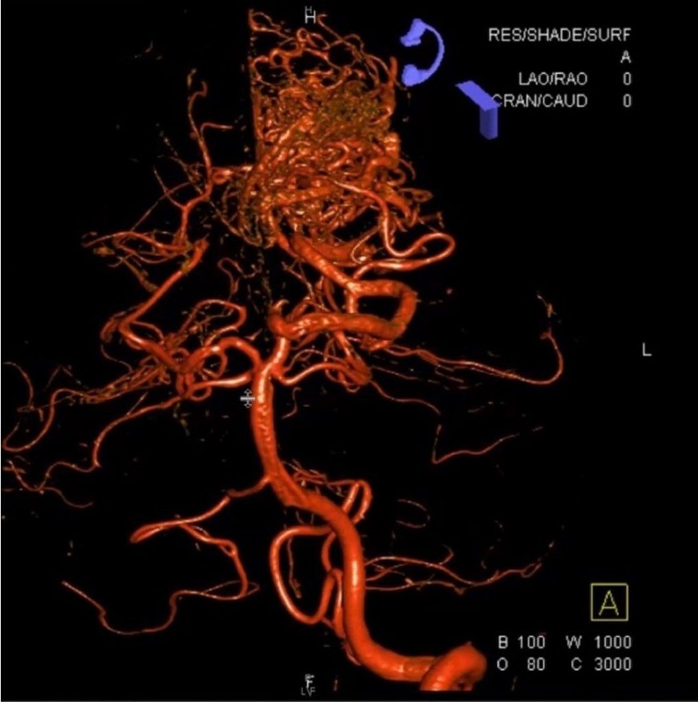 From the OR to the Swiss Alps, mom of 4 with rare brain disorder on ...